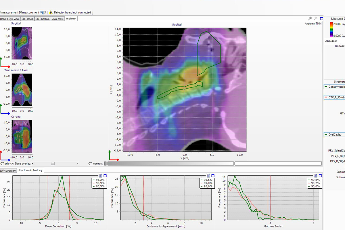 Delta4DVH Anatomy | Delta4 Family