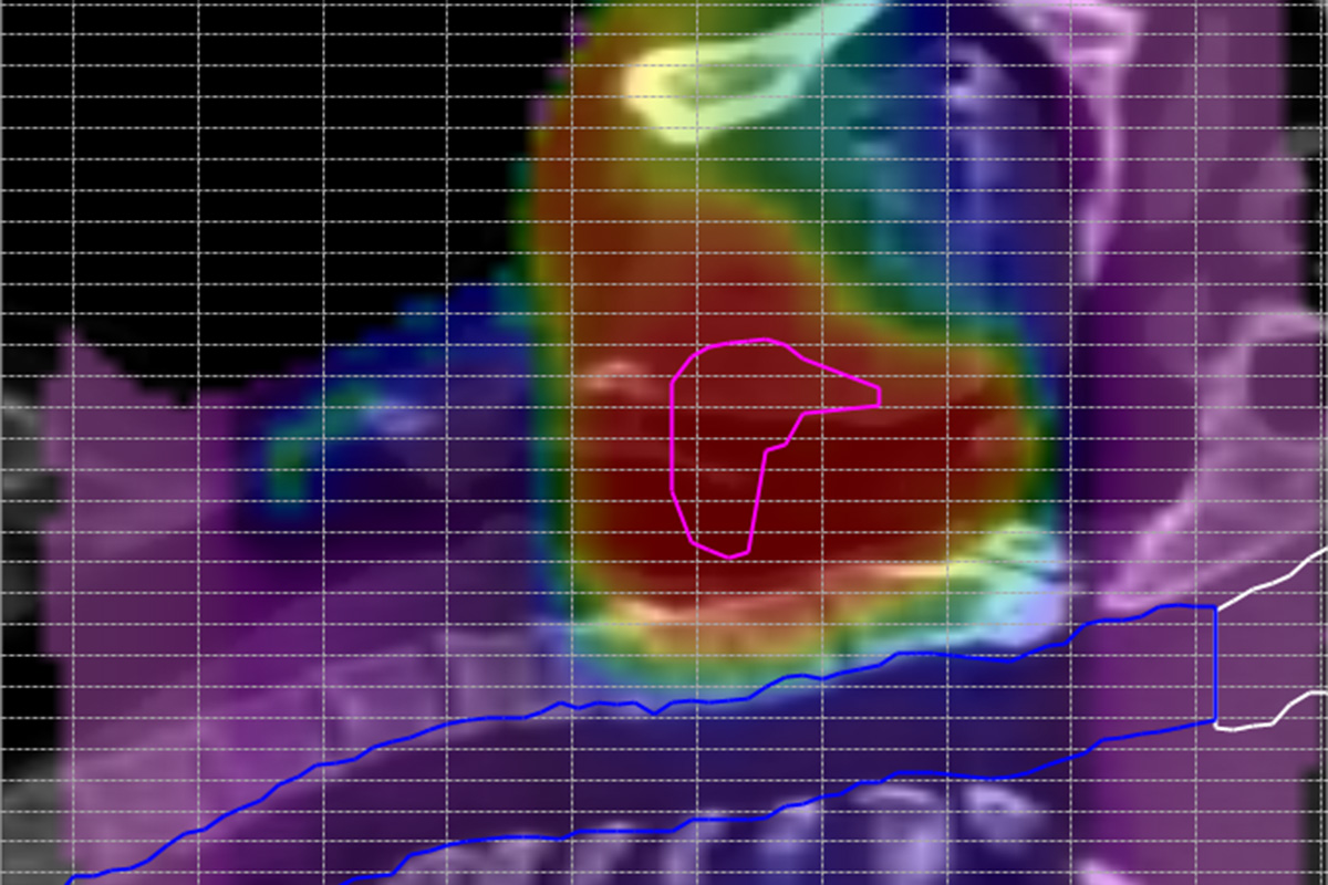 Delta4DVH Anatomy | Delta4 Family